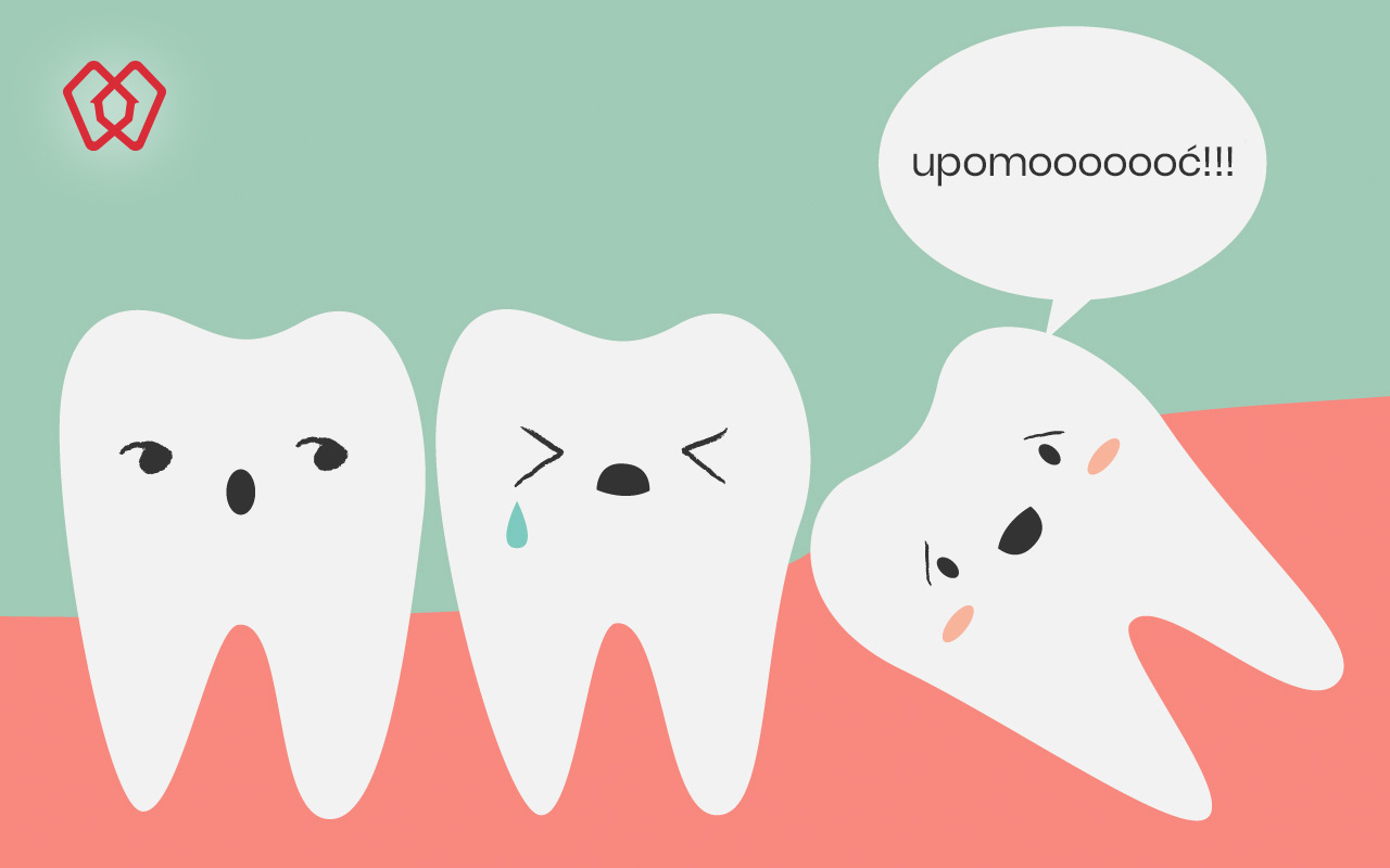 Sve što trebate znati o umnjacima - Dental House Banja Luka