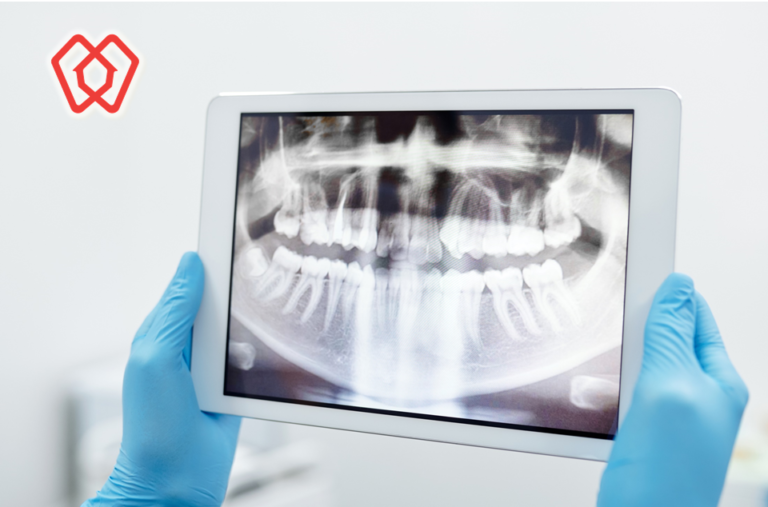 Da li je snimanje zuba štetno? - Dental House Banja Luka